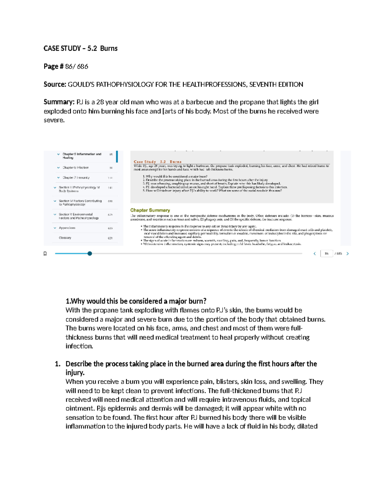 Patho CASE Study 2 - CASE STUDY – 5 Burns Page # 86/ 686 Source: GOULD'S PATHOPHYSIOLOGY FOR THE ...