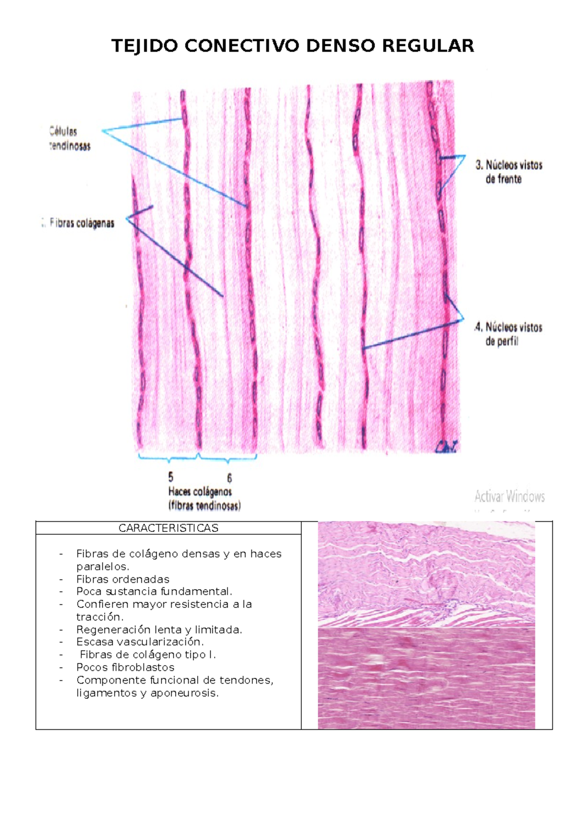 Tejido Conectivo Denso Regular - HISTOLOGIA - TEJIDO CONECTIVO DENSO ...