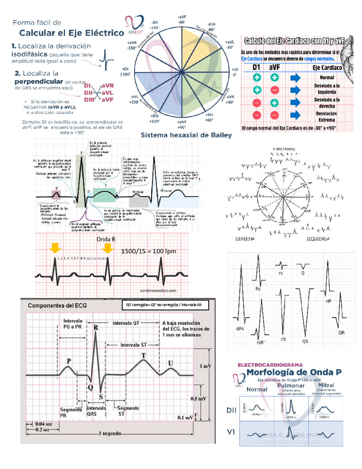 Chafa elektro - Imagenes de referencia para la comprensión de un ...