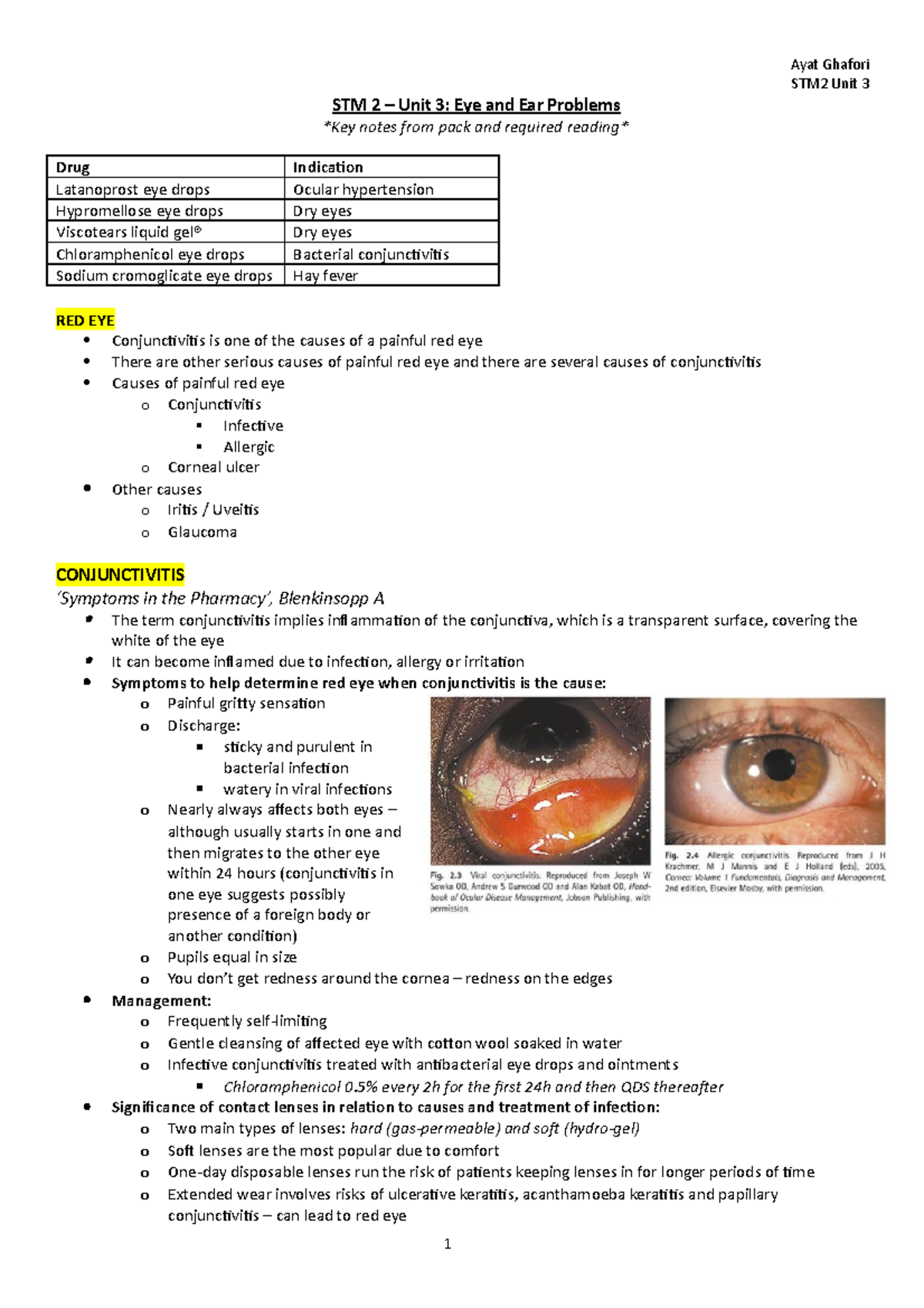 STM2 Unit 3 notes - Unit 3 - eyes and ears - STM2 Unit 3 STM 2 – Unit 3 ...