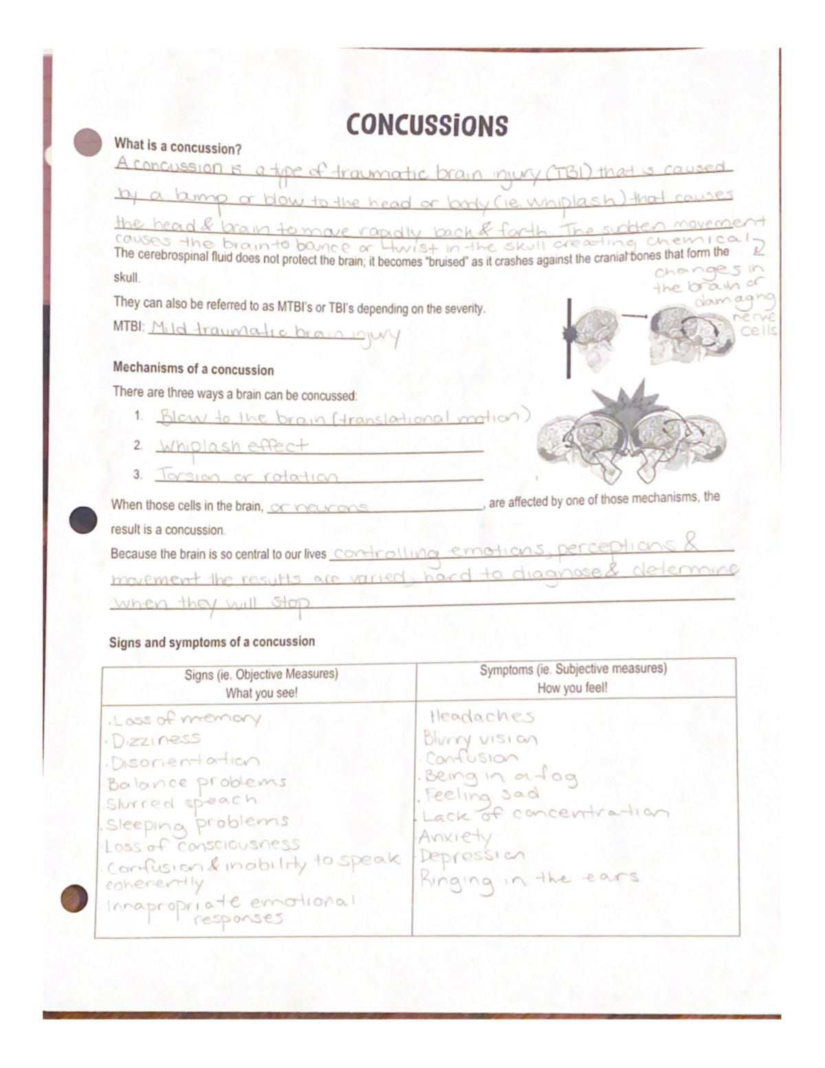 Concussions - Kinesiology notes intro to grade 12 kin - KIN255 - Studocu