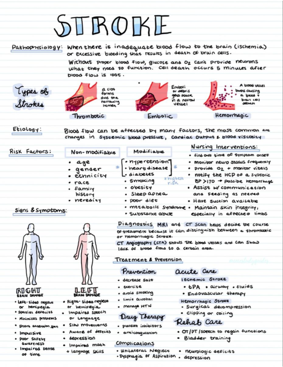 Stroke Nursing School Notes - Part of the Advanced Med-Surg Bundle ...