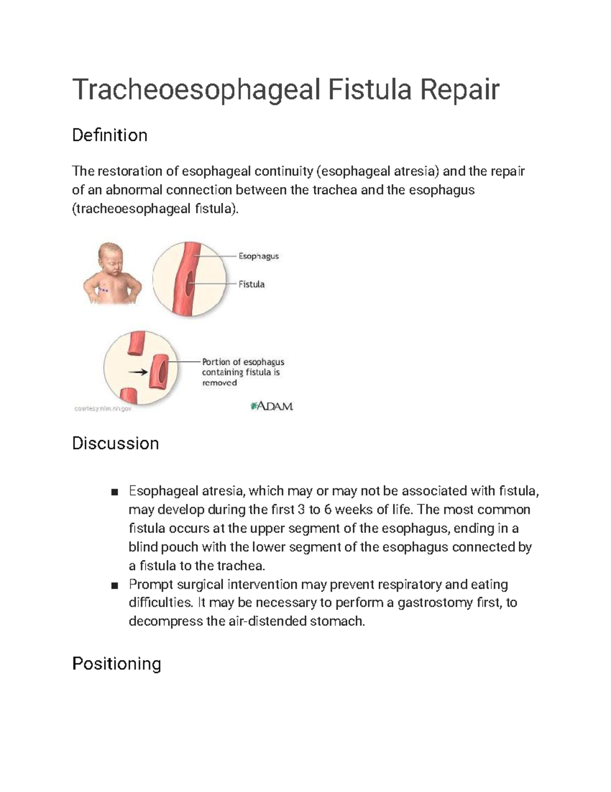 Tracheoesophageal Fistula Repair - Tracheoesophageal Fistula Repair ...