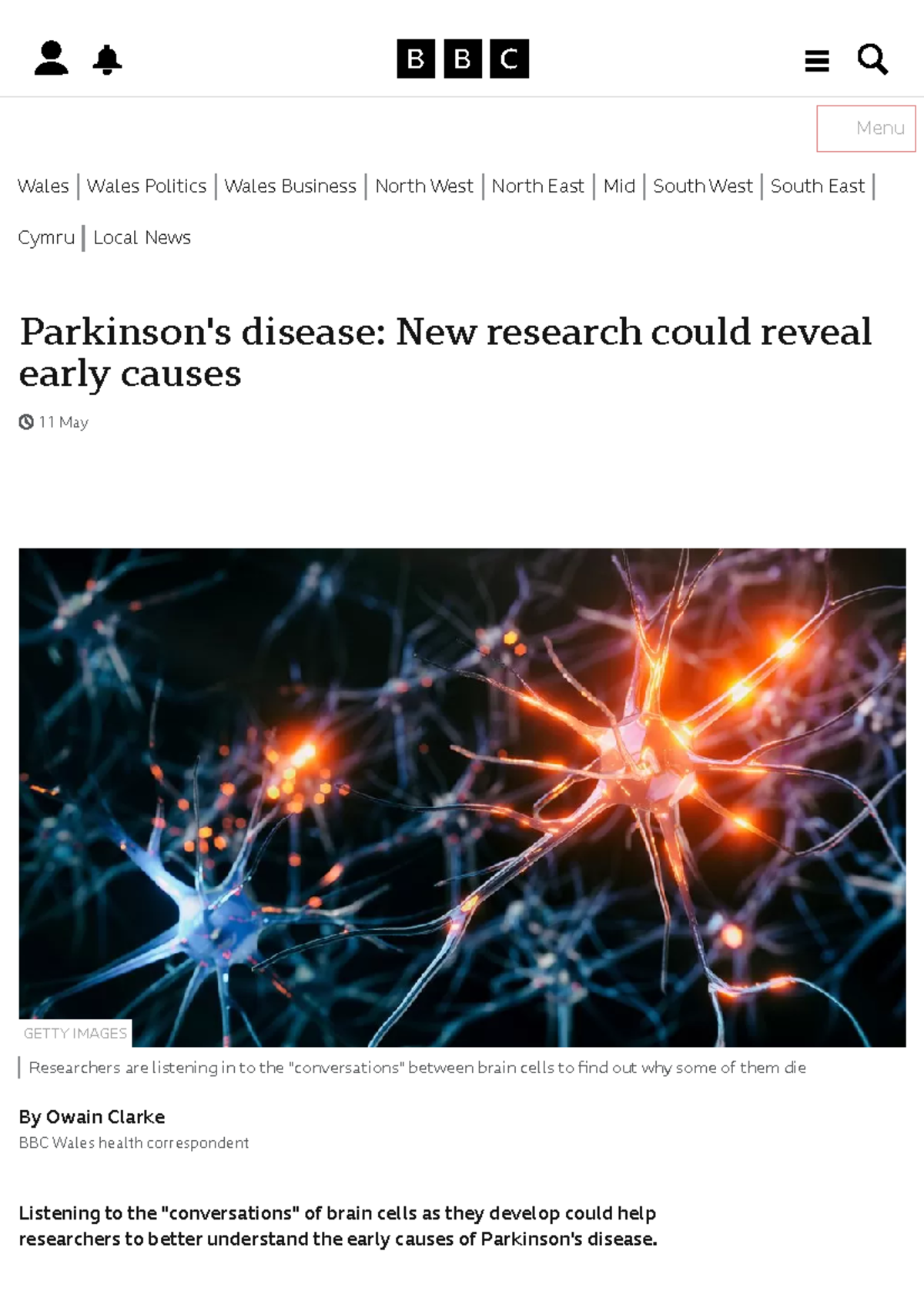 Parkinson's disease New research could reveal early causes - BBC News ...
