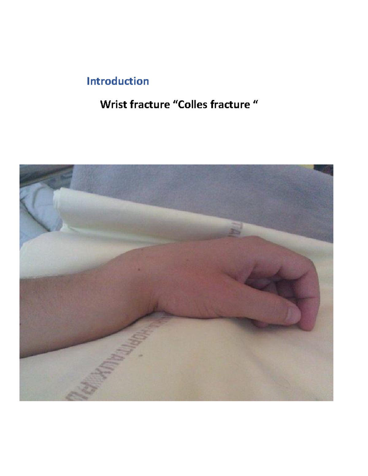Wrist%20fracture - Physiology - Introduction Wrist fracture “Colles ...