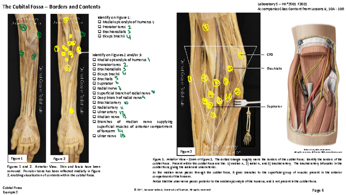 Lab 5 Manual filled in with the labels - The Cubital Fossa –Borders and ...