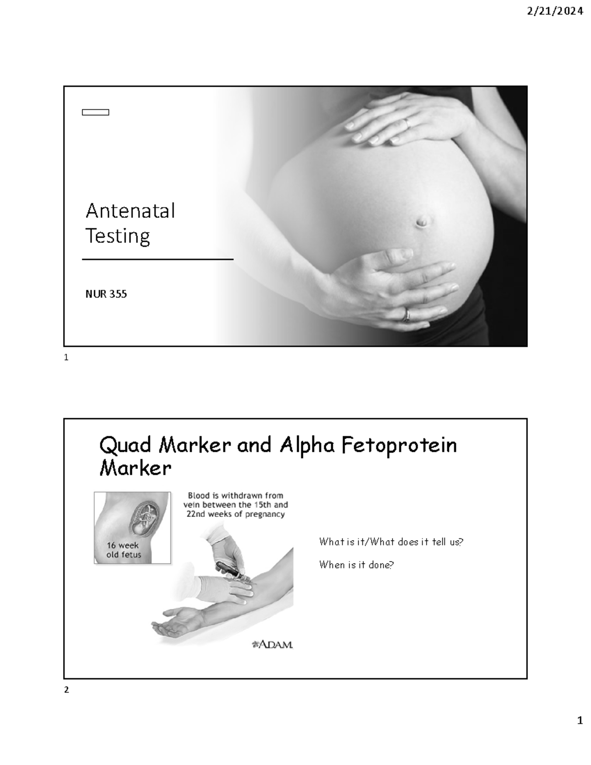 NUR 355 Antenatal Testing Printout - Antenatal Testing NUR 355 Quad ...