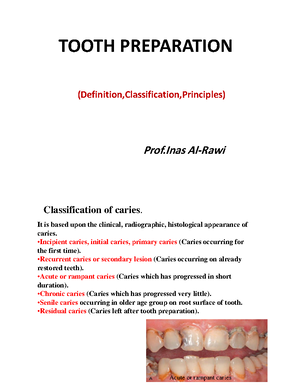 Class II Cavity Preparation Characteristics OF AN Ideal Class II ...