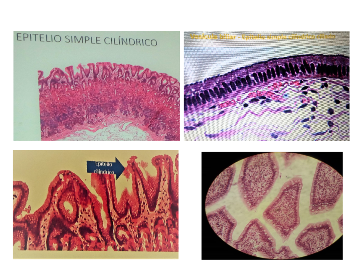Epitelio Cilindrico Simple (1) - Histología - Studocu