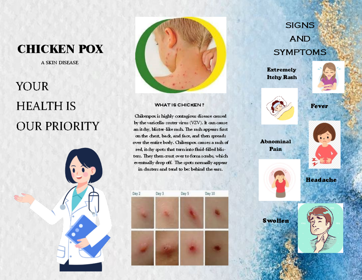 RIZA Brochure - Nursing - CHICKEN POX A SKIN DISEASE YOUR HEALTH IS OUR ...