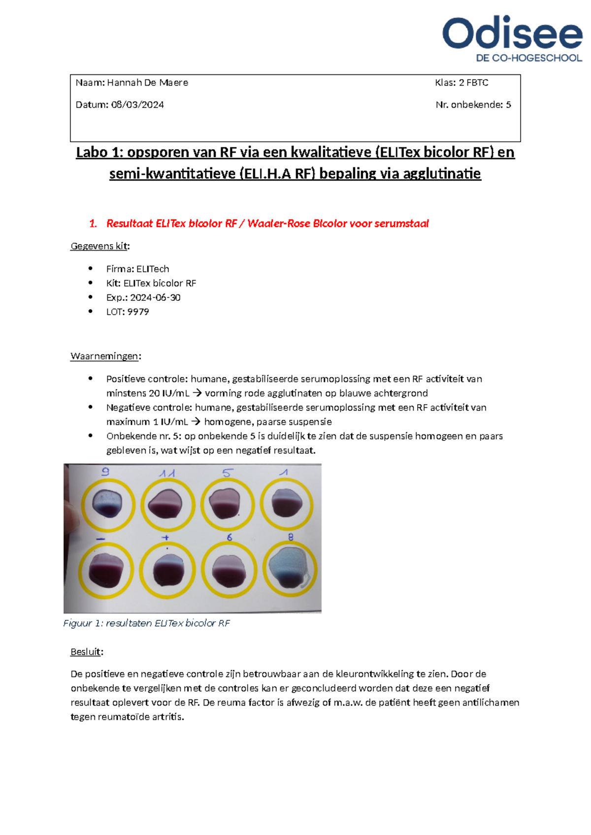 Hannah De Maere 2FBTC RF - Naam: Hannah De Maere Klas: 2 FBTC Datum: 08 ...