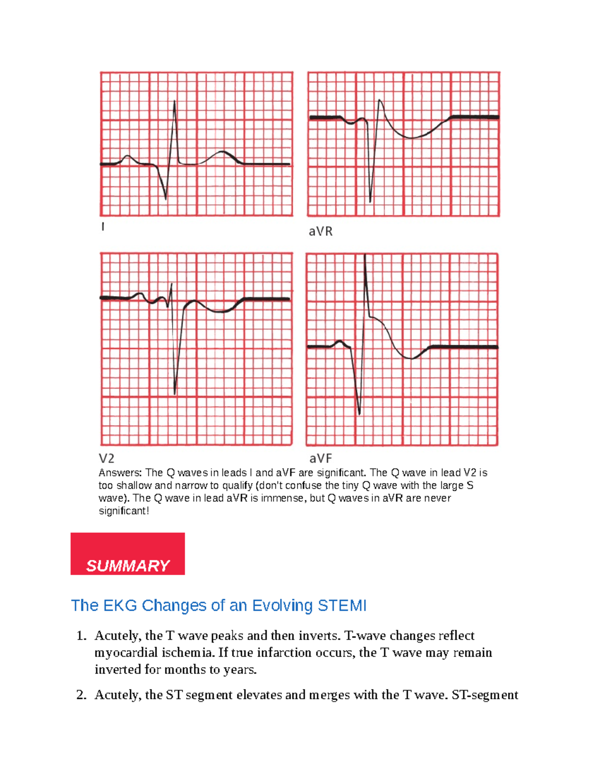 The only EKG-87 - The only EKG - Answers: The Q waves in leads I and ...