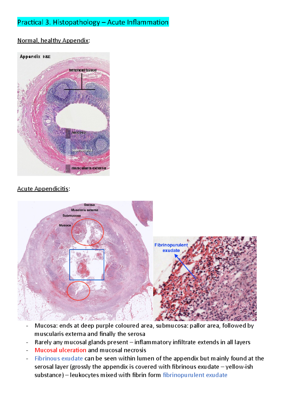 Practical 3 - Practical 3. Histopathology – Acute Inflammation Normal ...