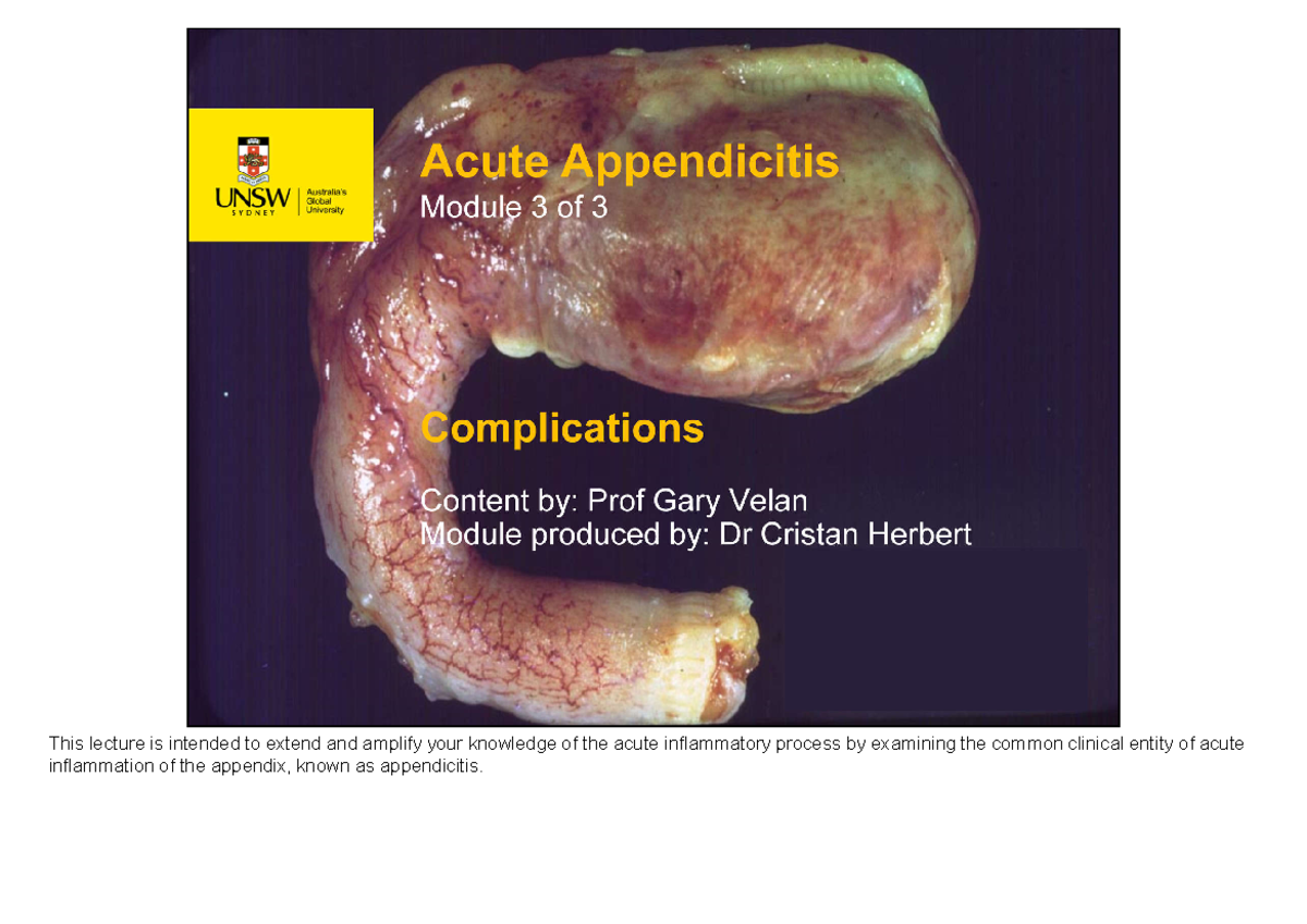 06 - Appendicitis module 3 - This lecture is intended to extend and ...