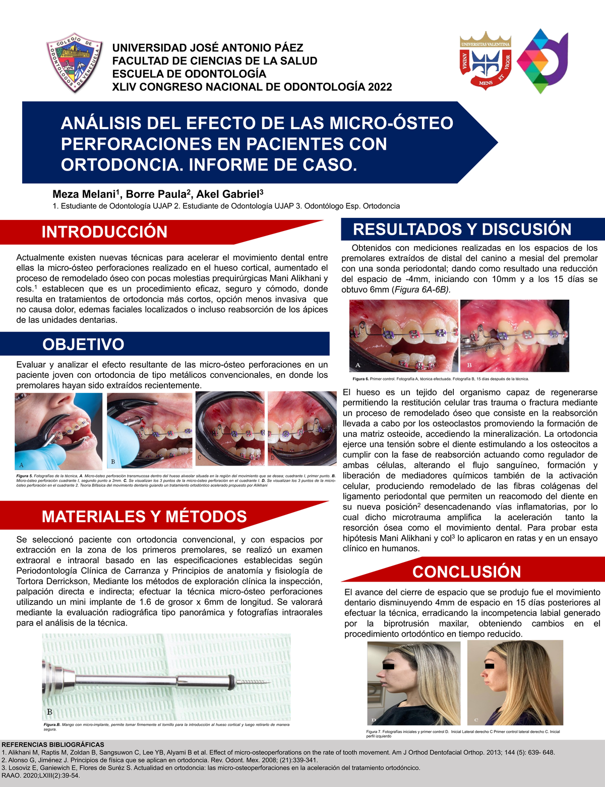 Poster ANÁ Lisis DEL Efecto DE LAS Micro-ÓSTEO Perforaciones EN ...
