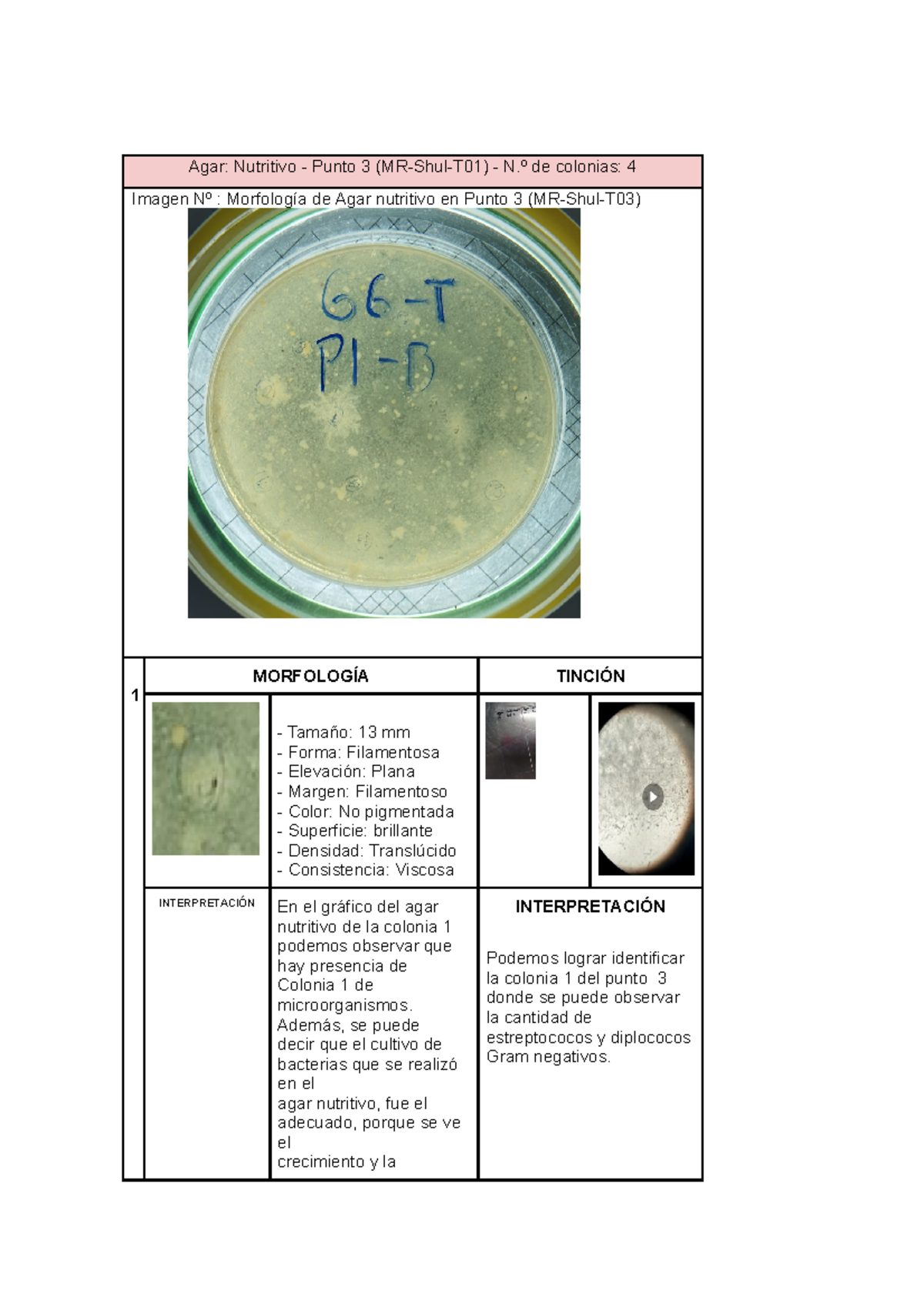 Agar 2 - interpretaciones de agares - Agar: Nutritivo - Punto 3 (MR ...