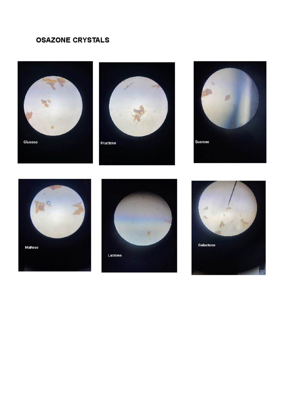 Osazone- Crystals - Biochemistry - Bachelor of Science in Nursing ...