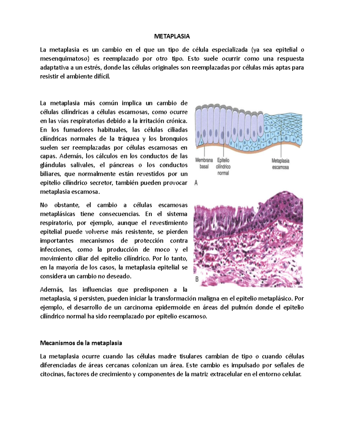Hiperplasia Y Metaplasia - METAPLASIA La metaplasia es un cambio en el ...
