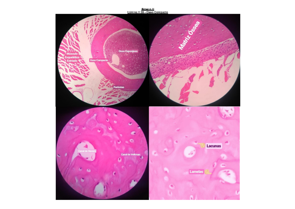 2º Ano - Módulo 7 - Roteiro 3 - Histologia - Ossos - Roteiro III Lâmina ...