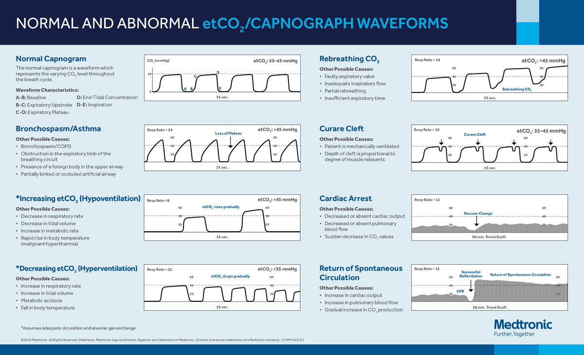 Scribd - Waveform Characteristics: A-B: Baseline B-C: Expiratory ...