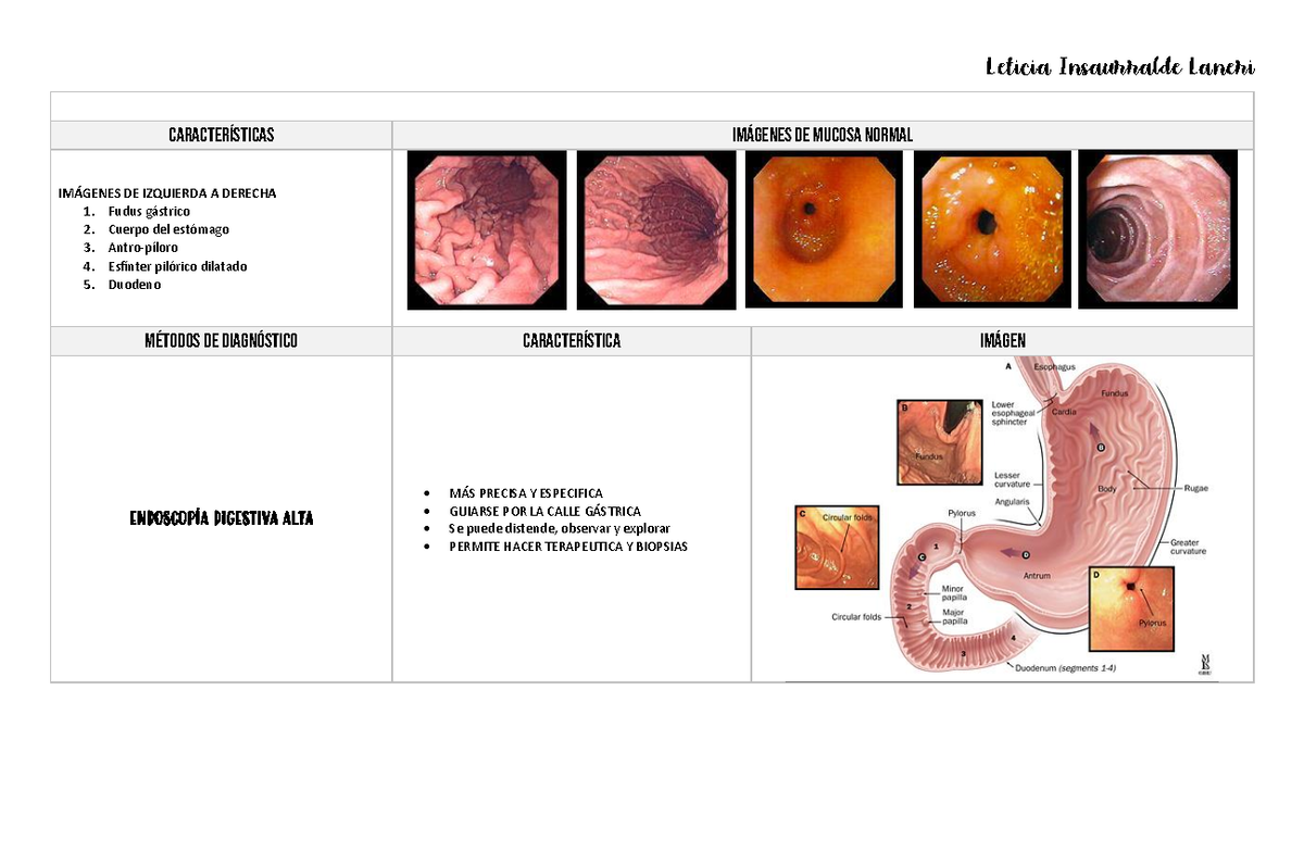 Patologias Benignas DEL Estómago - Warning: TT: undefined function: 32 CARACTERÍSTICAS IMÁGENES ...