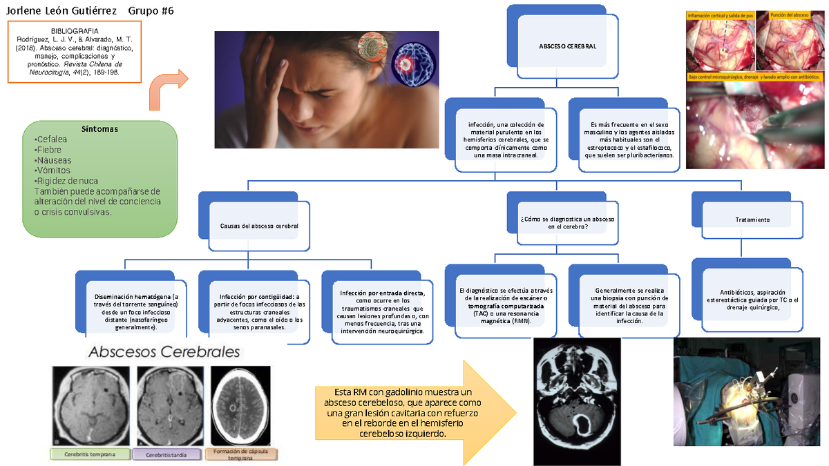 Absceso cerebral - Jorlene LEON G - Jorlene LeÛn GutiÈrrez Grupo ...
