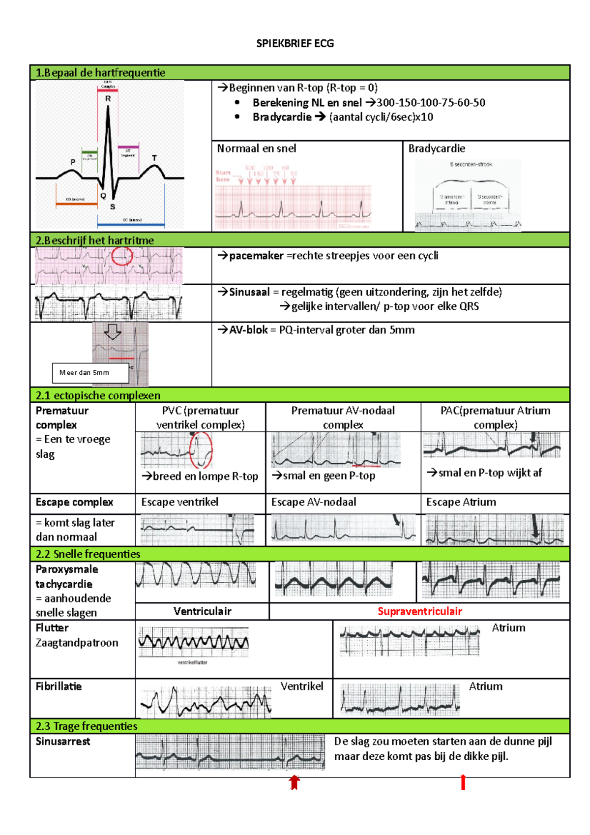 Spiekbrief cardio - SPIEKBRIEF ECG 1 de hartfrequentie Beginnen van R ...
