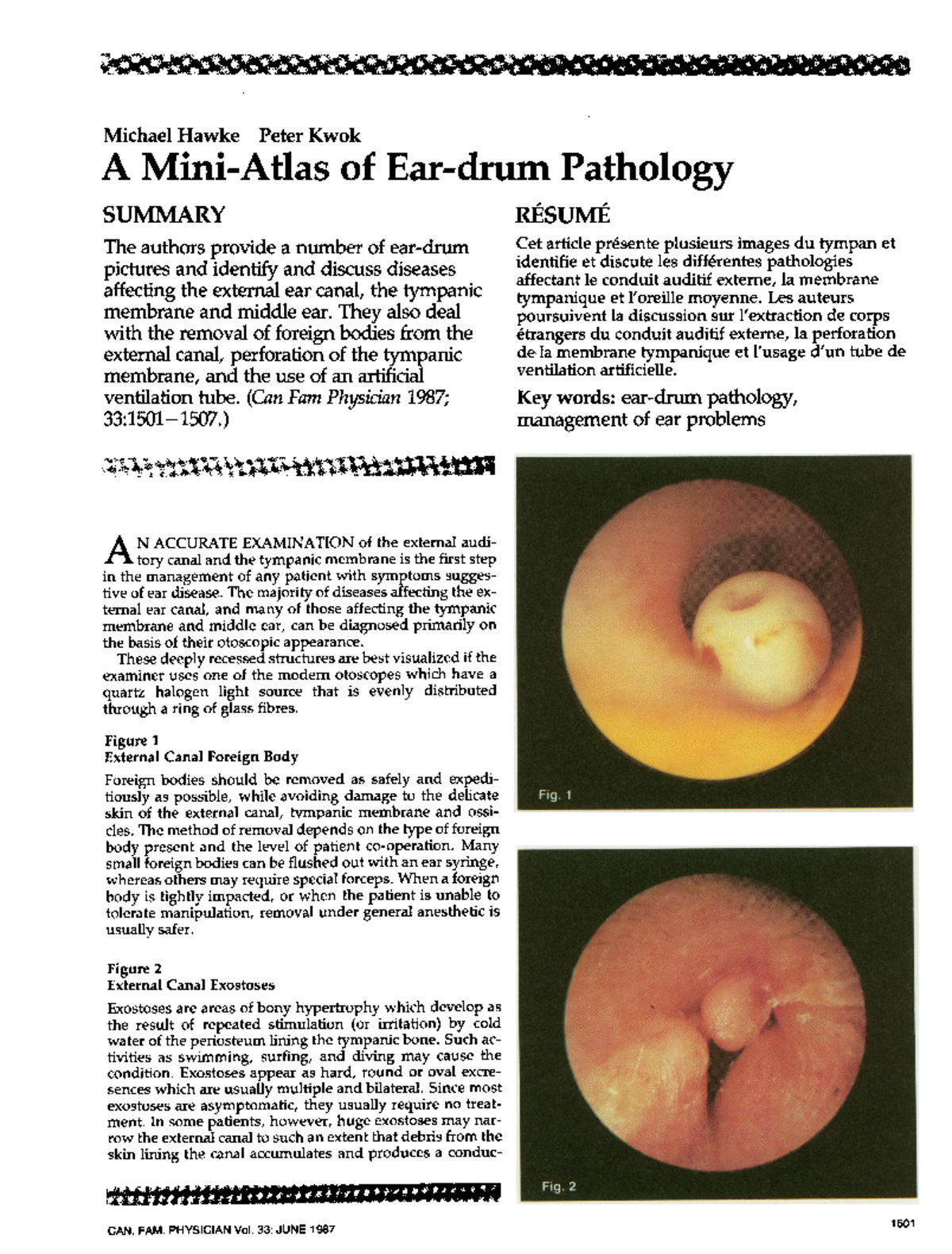 Tympanic membrane pathology atlas - Michael Hawke Peter Kwok A Mini ...