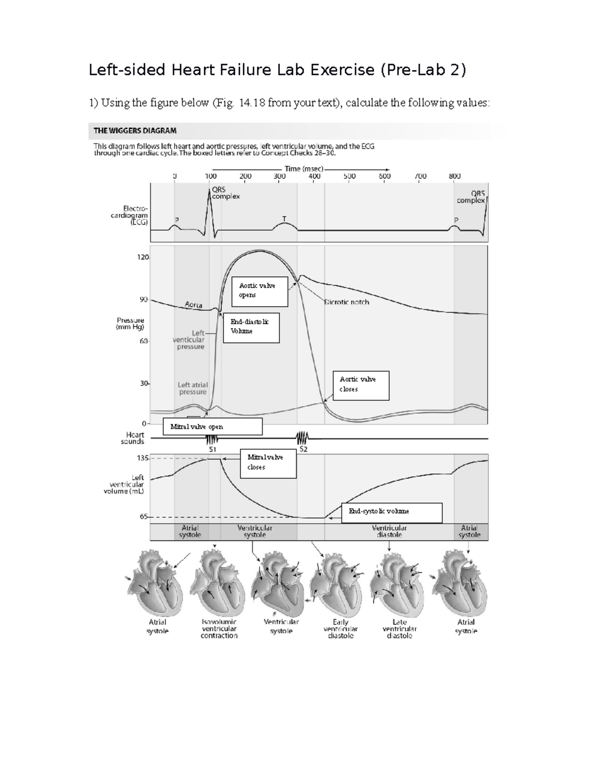 Cardiovascular Prelab Week 9 - Left-sided Heart Failure Lab Exercise ...