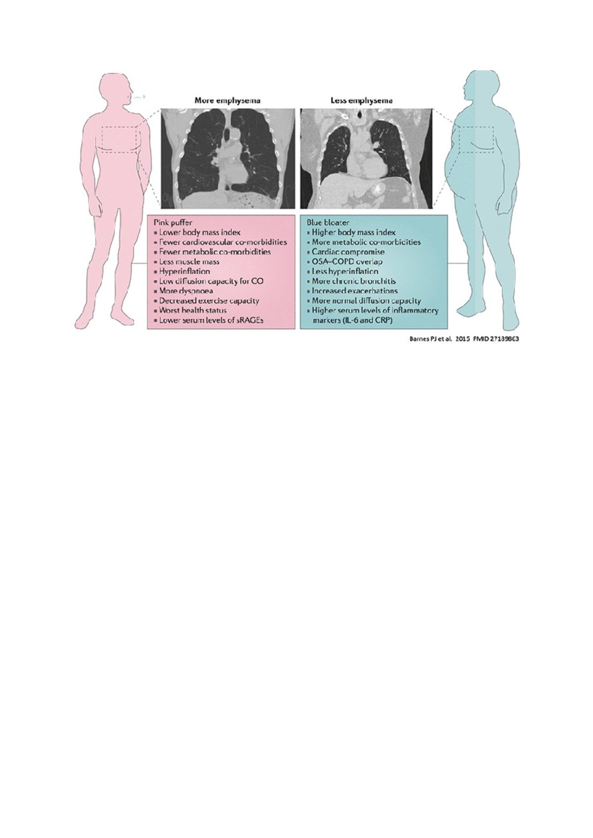 Blue bloater en pink puffer - More emphysema Less emphysema Pink puffer ...