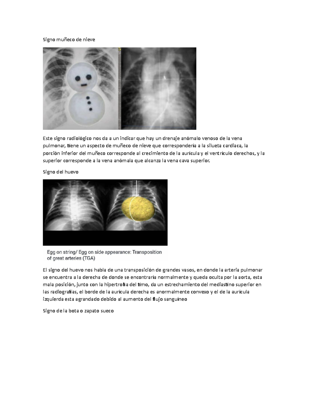 signos radiologicos de torax - Imagenología I - UAZ - Studocu