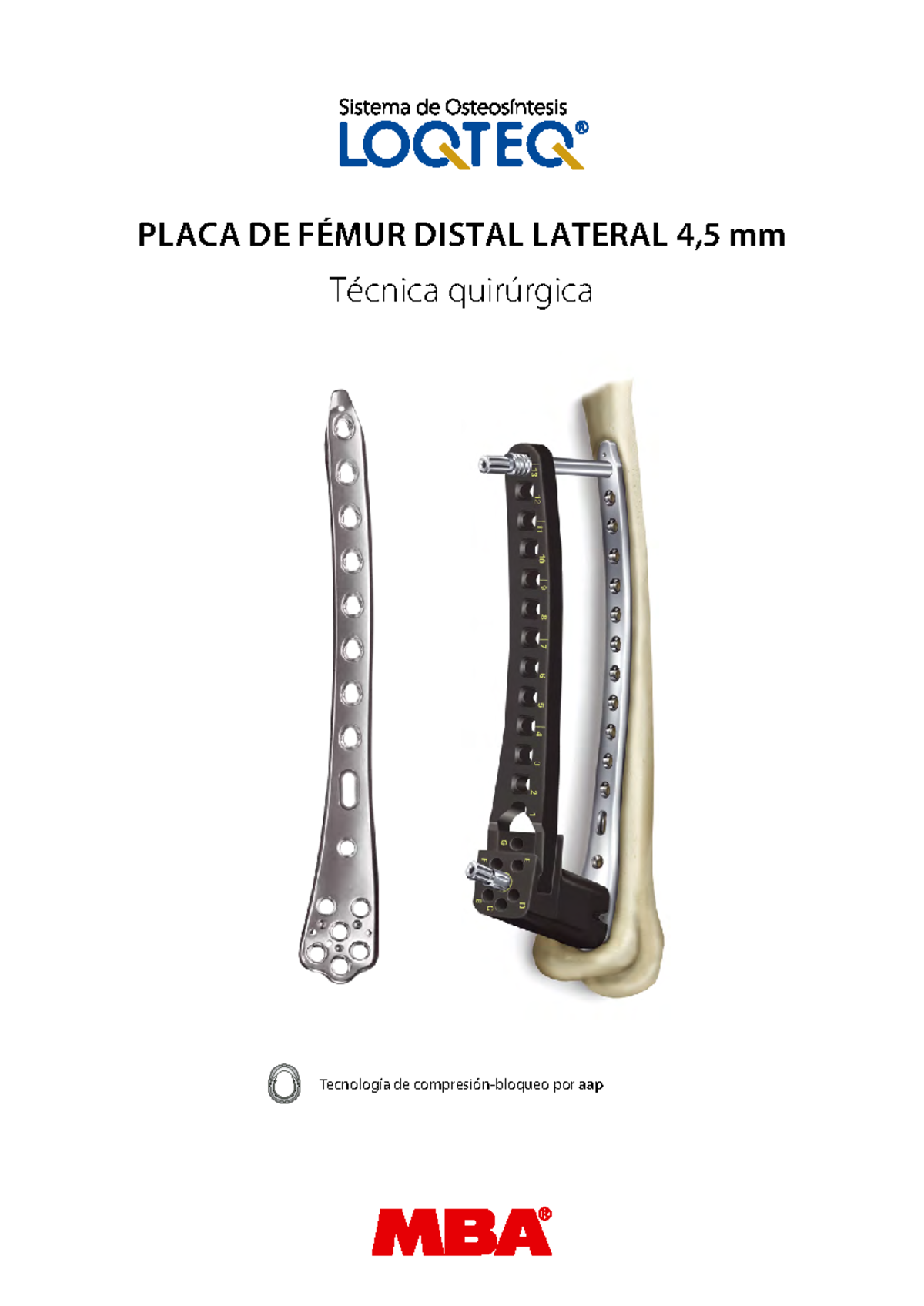 Qx Femur - PLACA DE FÉMUR DISTAL LATERAL 4,5 mm Técnica quirúrgica ...