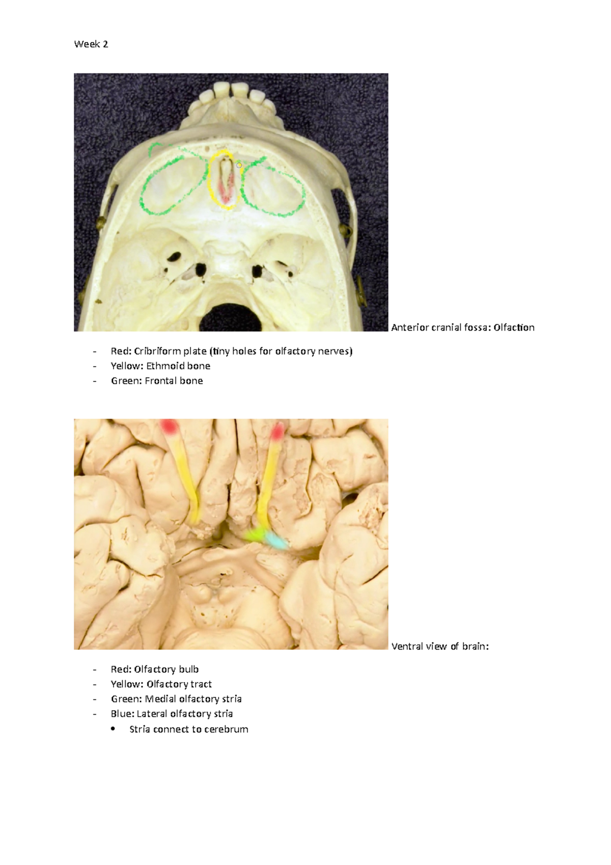 NEUR3005 Week 2 Tutorial Structures - Anterior cranial fossa: Olfaction Red: Cribriform plate ...