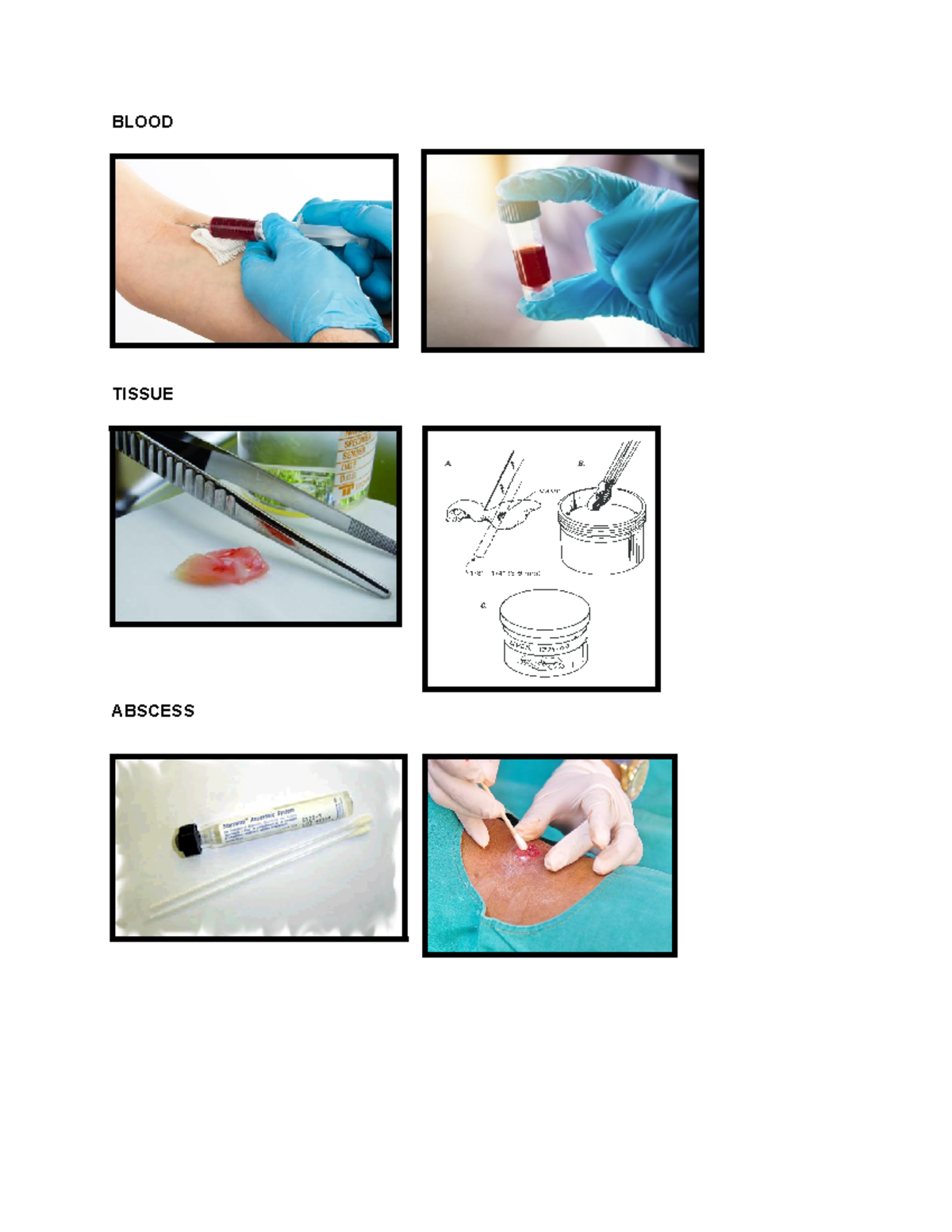 Bacte-pics - Specimen collection - Science Technology Engineering ...