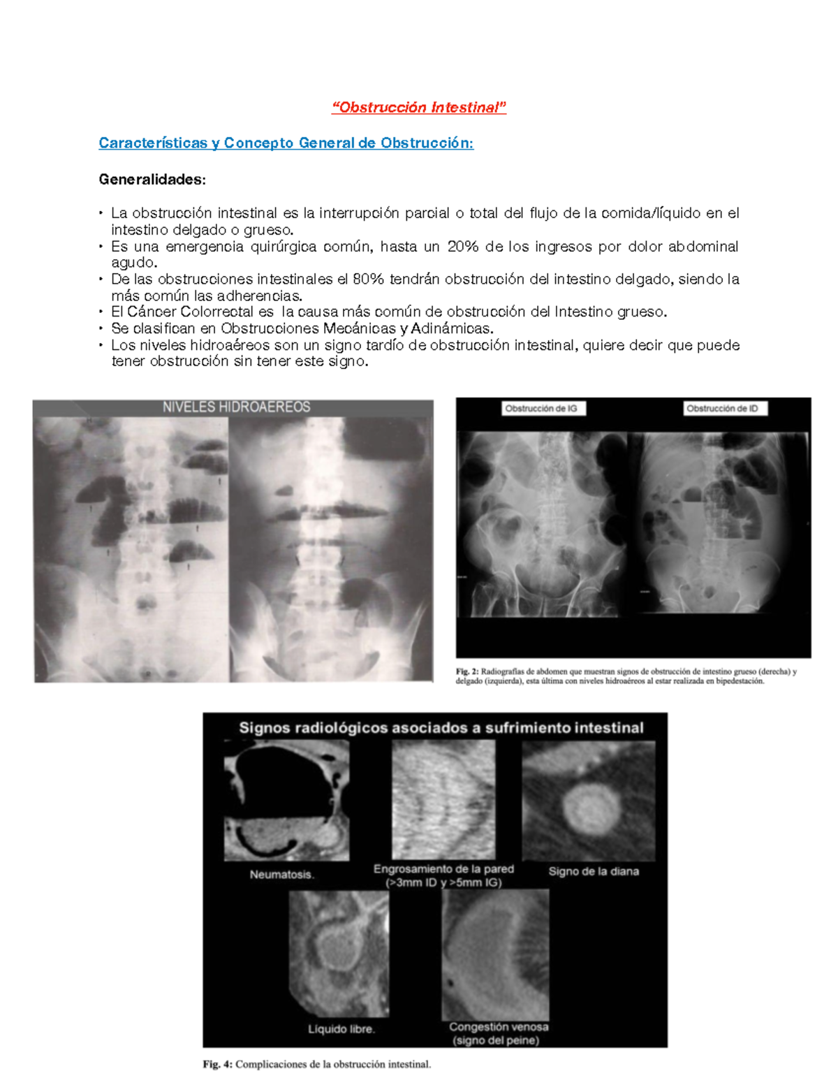 Obstrucción Intestinal - “Obstrucción Intestinal” Características y ...