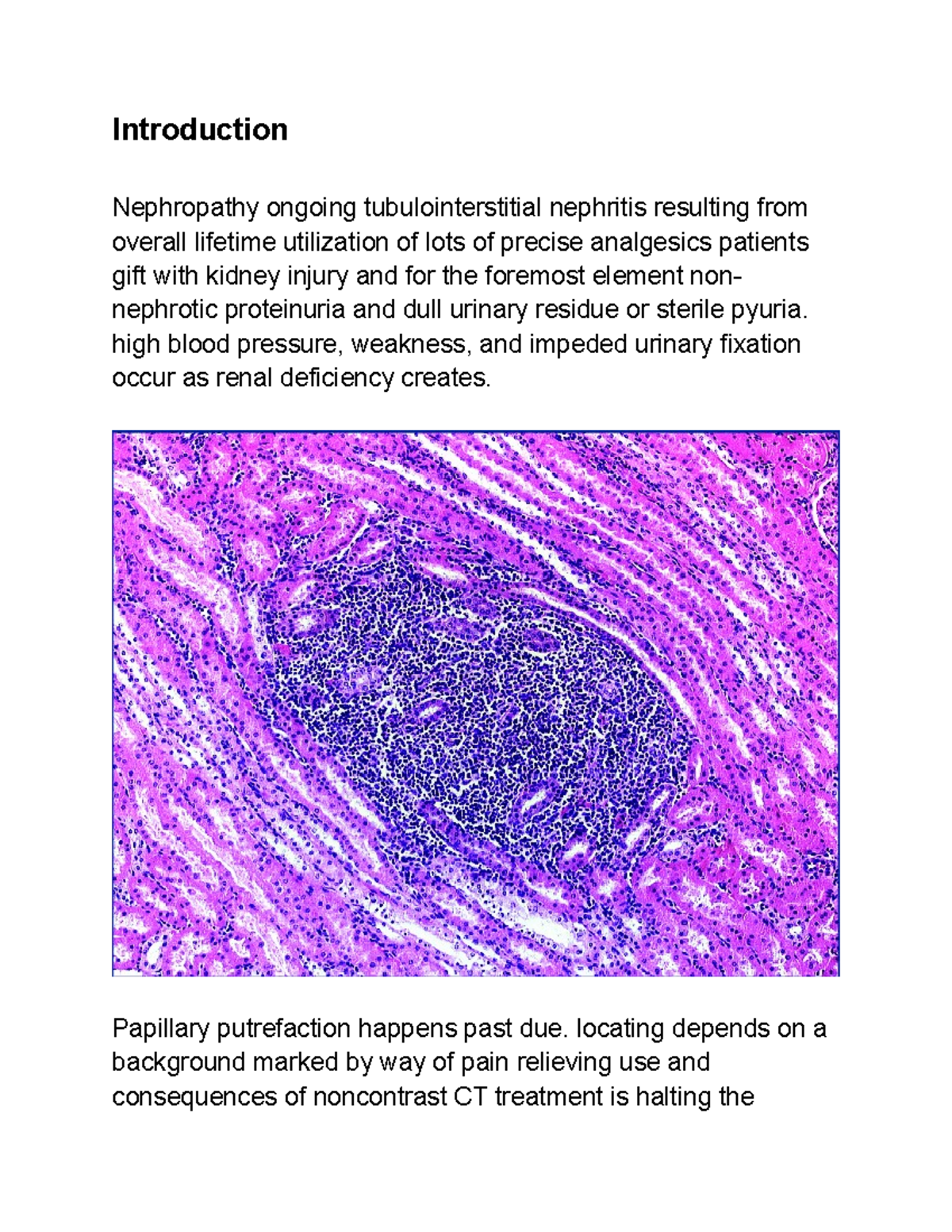 Tubulointerstitial Nephritis - high blood pressure, weakness, and ...