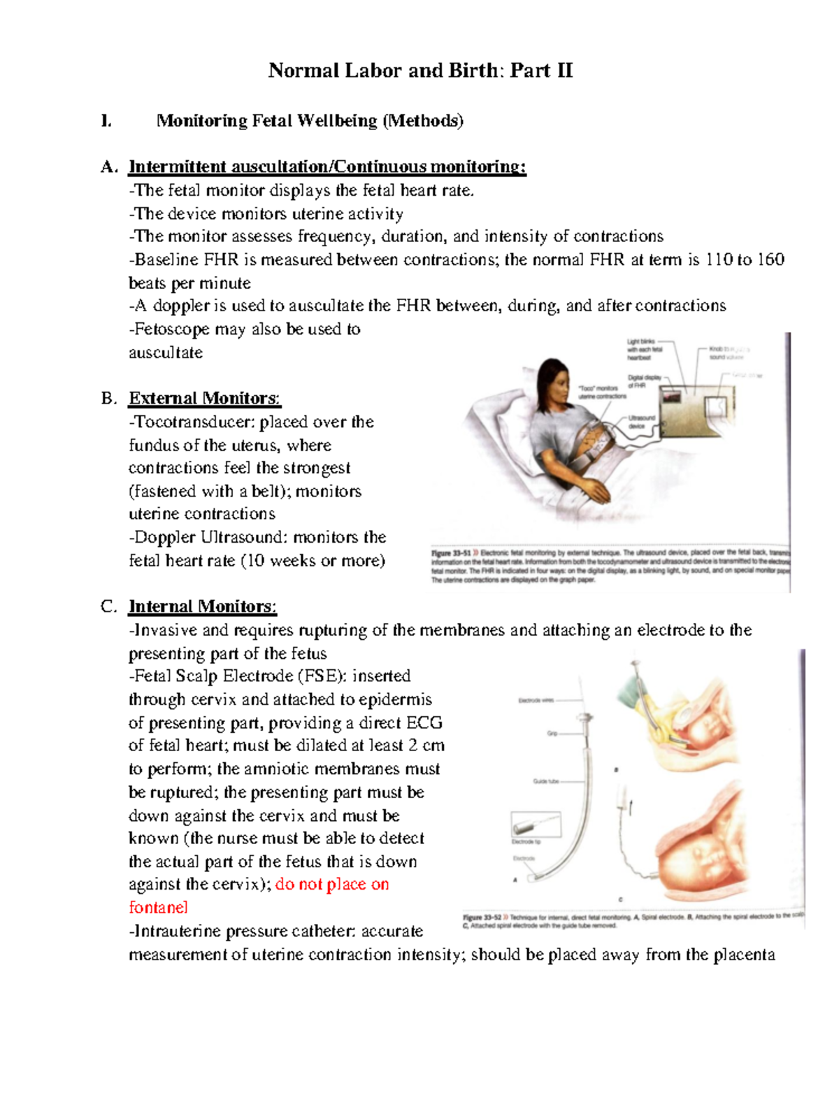 Intrapartum 2 - Normal Labor and Birth : Part II I. Monitoring Fetal ...