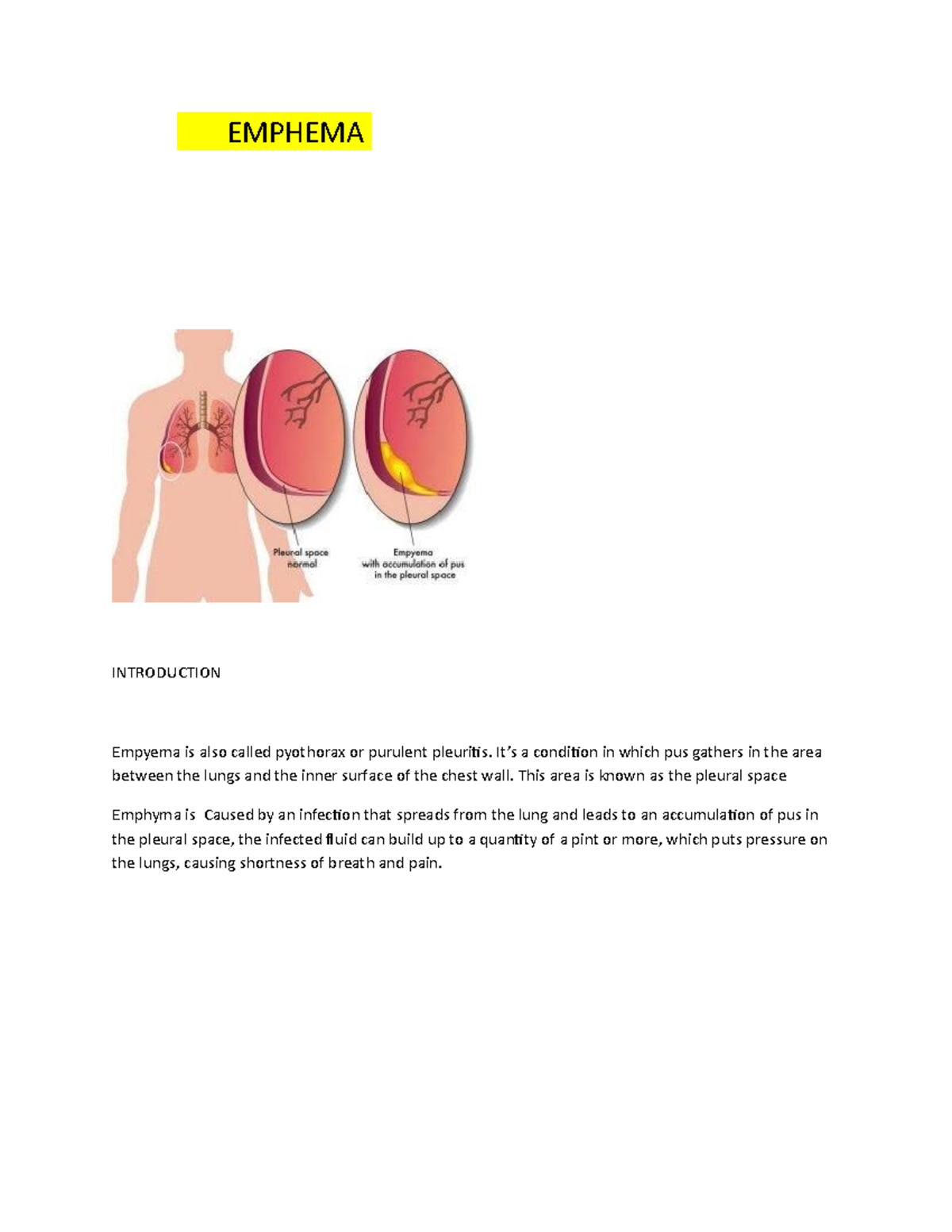 Emphema-WPS Office - Lecture notes - EMPHEMA INTRODUCTION Empyema is ...