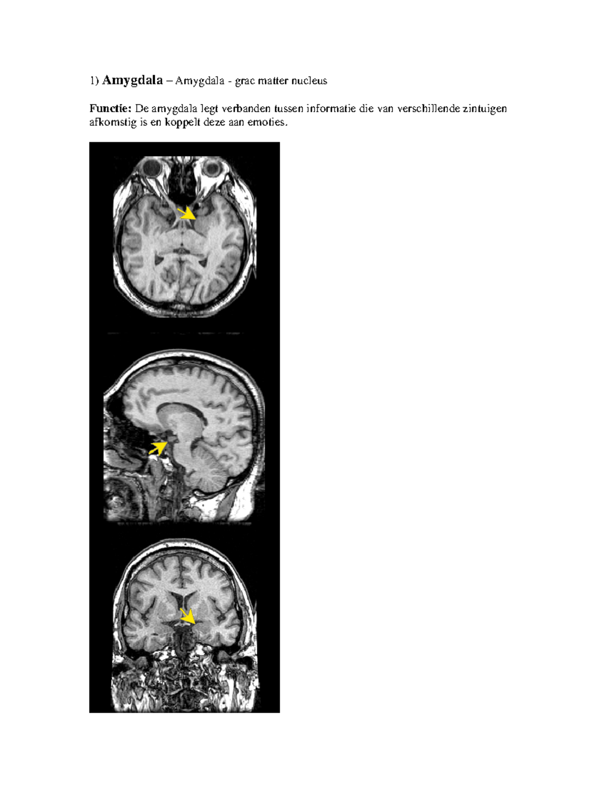 Aantekeningen Hersenstructuren afgebeeld in MRI - 1) Amygdala ...
