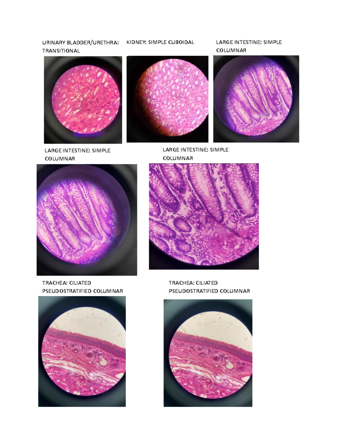 Sample Specimen prelims - URINARY BLADDER/URETHRA: TRANSITIONAL KIDNEY ...