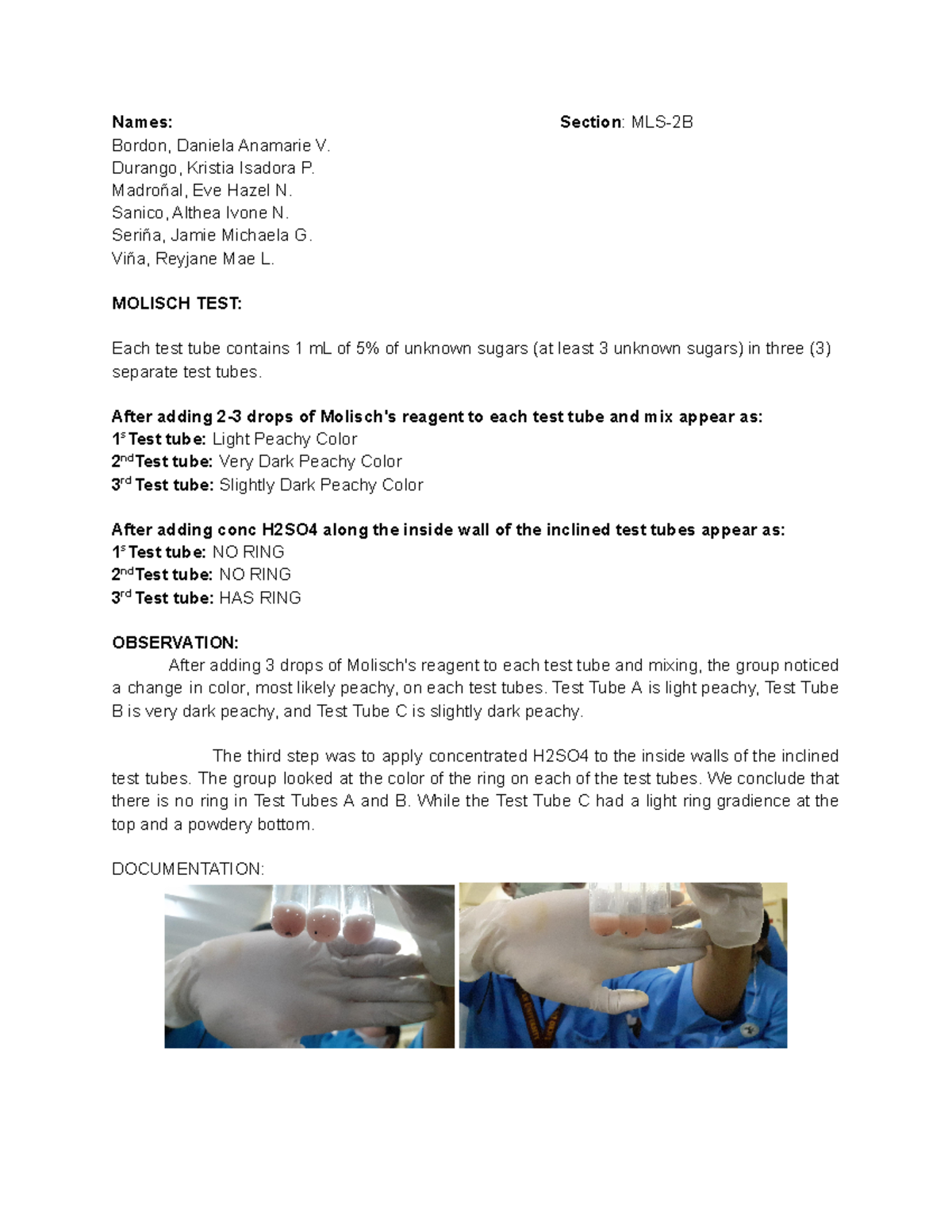 Biochem-LAB- Report - Names: Section: MLS-2B Bordon, Daniela Anamarie V ...