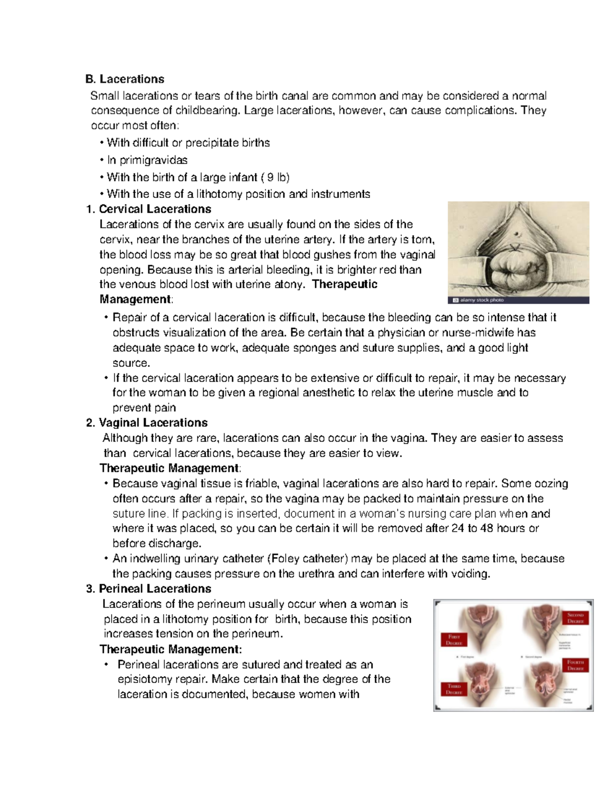 Lacerations - B. Lacerations Small lacerations or tears of the birth ...