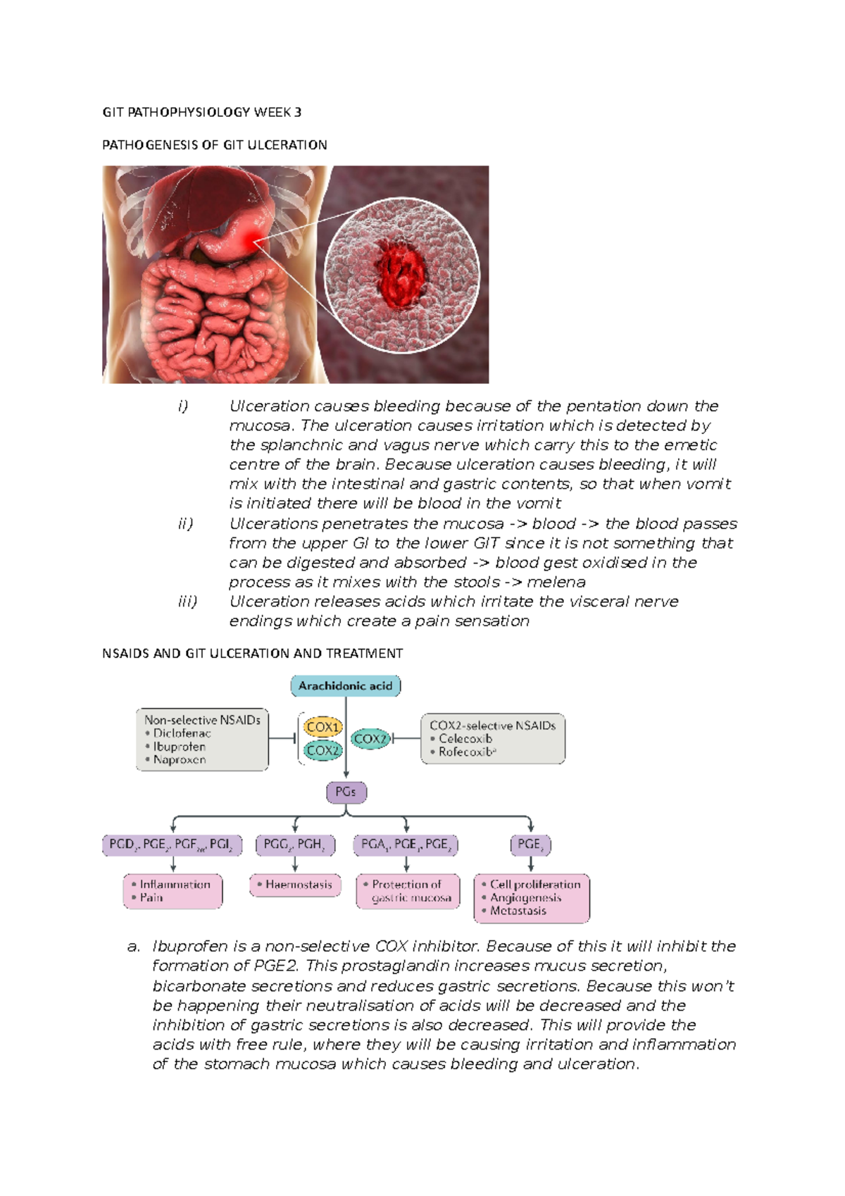 GIT Pathophysiology WEEK 3 - GIT PATHOPHYSIOLOGY WEEK 3 PATHOGENESIS OF GIT ULCERATION i ...