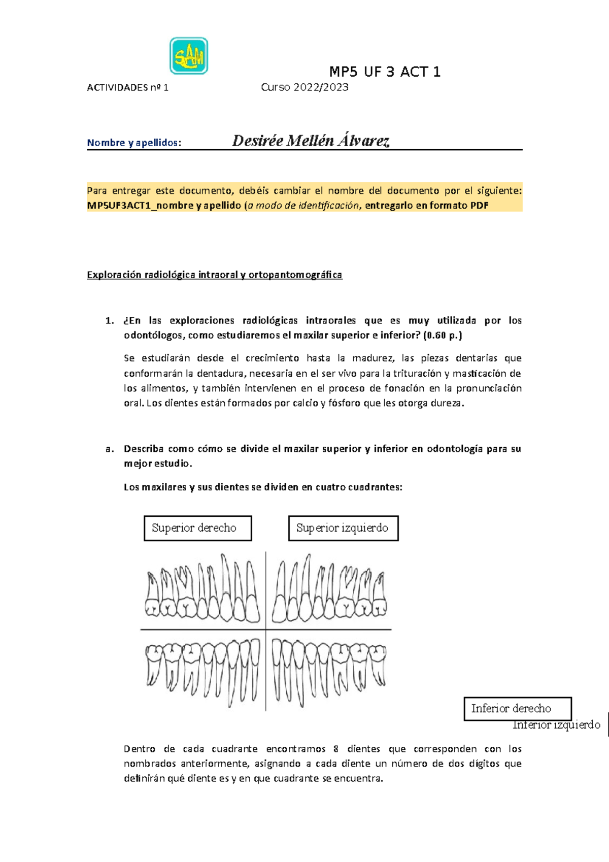MP5 UF3 Act 1 intraorales , ortopanto - ACTIVIDADES nº 1 Curso 2022/ Nombre y apellidos: Desirée ...
