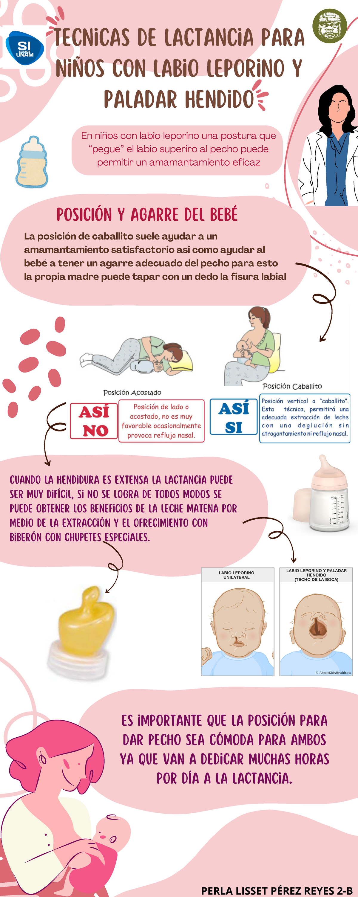 Tecnicas de lactancia para niños con labio leporino y paladar hendido - Tecnicas de lactancia ...