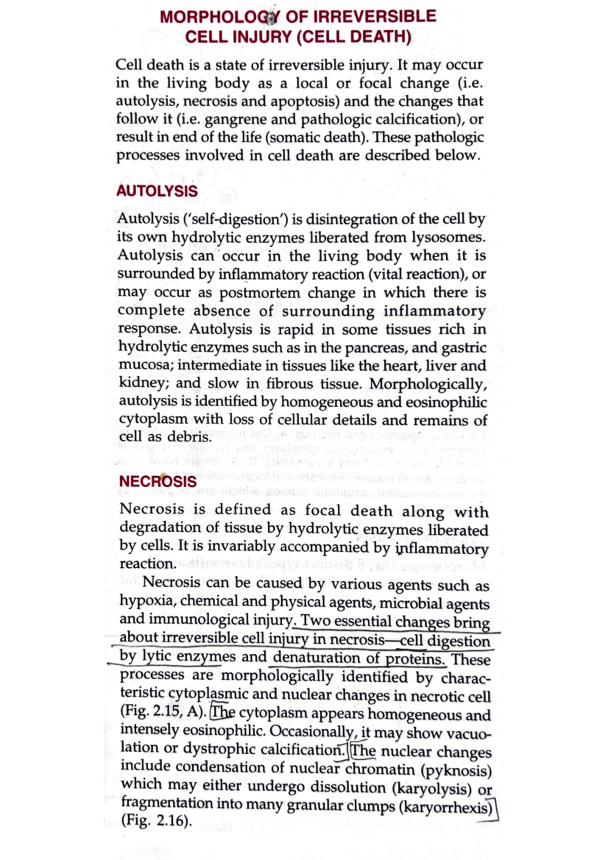 Morphology of irreversible Cell Injury(Cell Death) - Mbbs undergrad ...