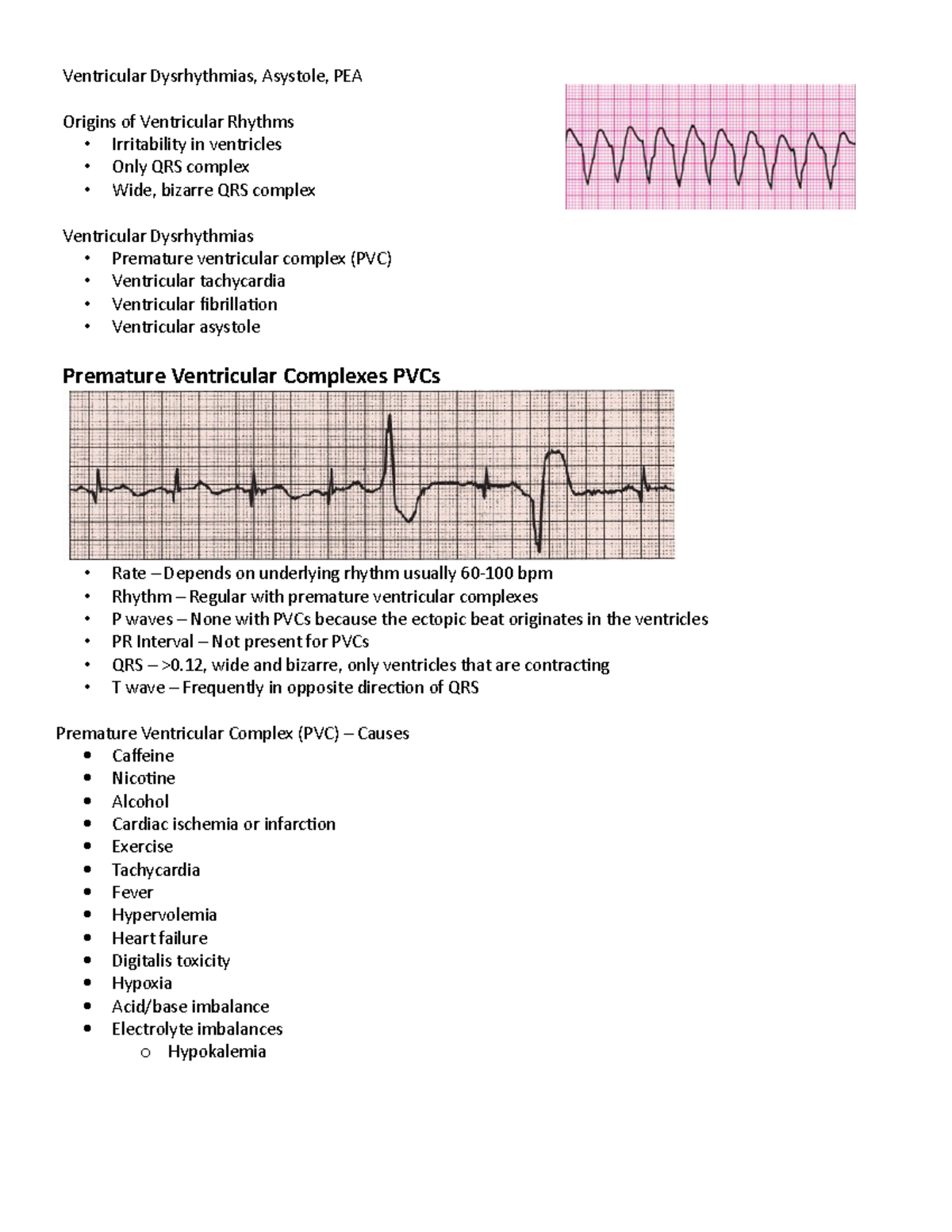2020-Nurs420 Critical care Ventricular Dysrhythmias lecture notes ...