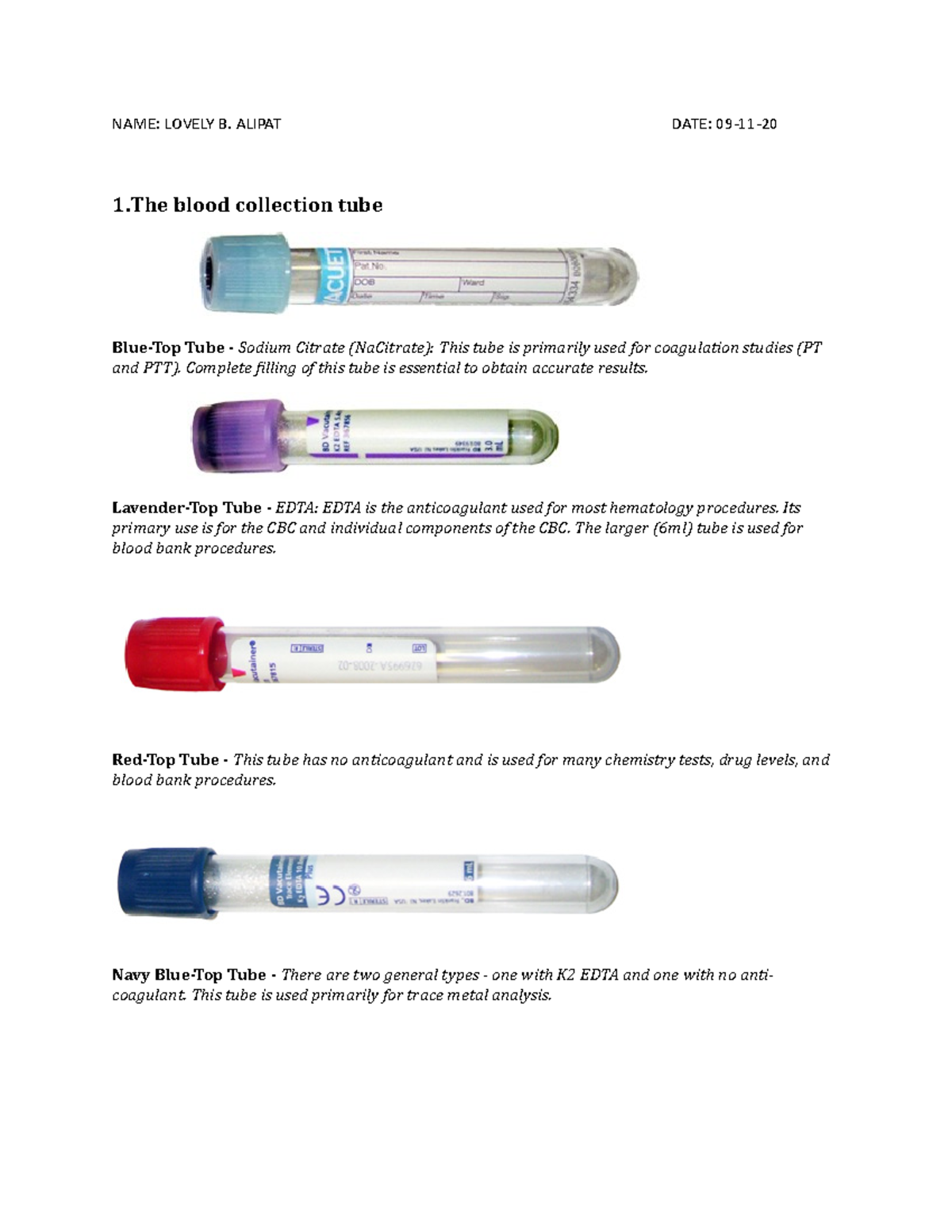 Collection tubes - toturial - NAME: LOVELY B. ALIPAT DATE: 09-11- 1 ...
