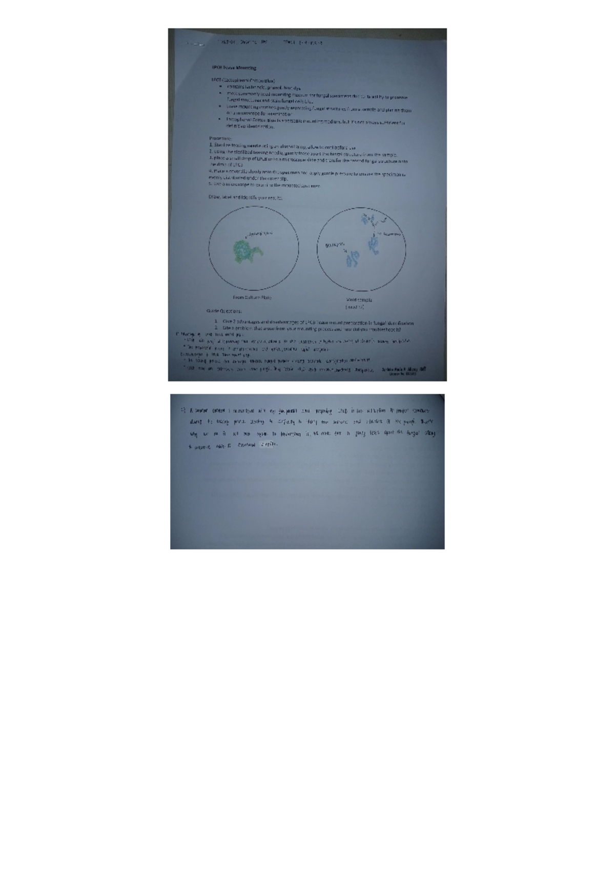 Prelims LAB Acitivity - Gew - LPCB Tease Mounting LPCB (Lactophenol ...