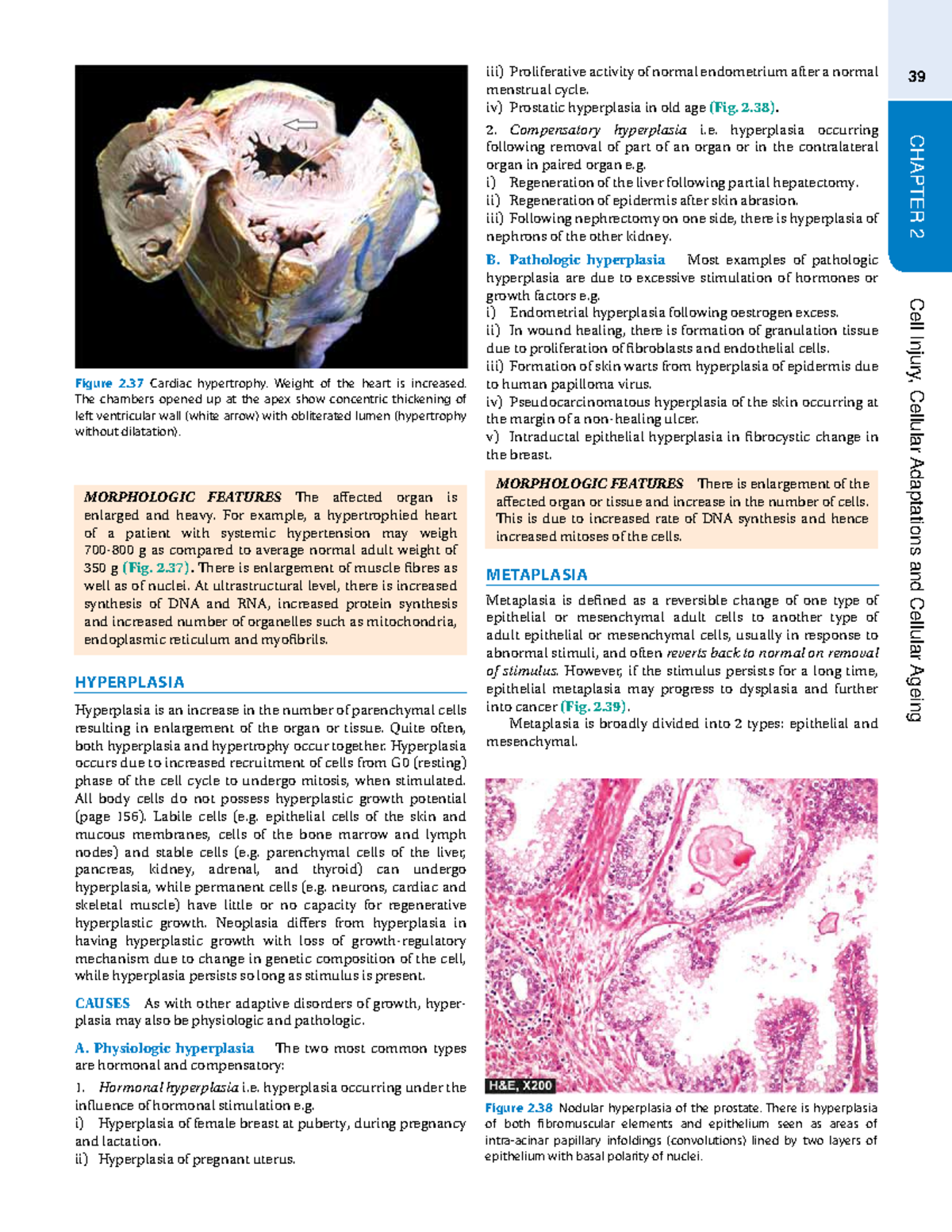 Harsh Mohan Textbook of Pathology, 7th edition-7 - 39 Cell Injury ...